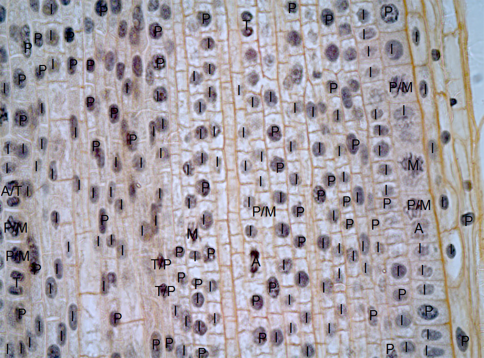 Pivot Interactives Mitosis In Onion Root Tips Answer Key Log In Pivot Pivot Interactives Mitosis In Onion Root Tips Answer Key Log In Pivot